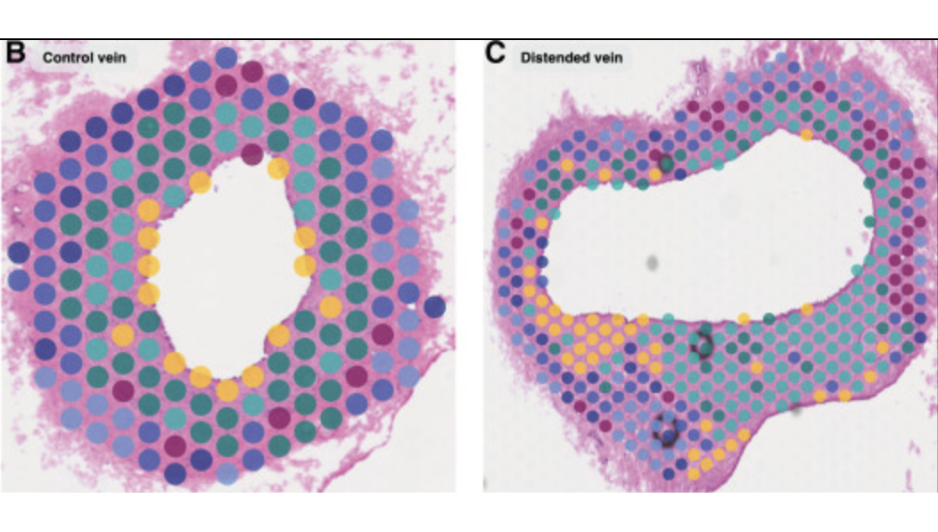 Spatial Transcriptomics & Spatial Biology - 10x Genomics